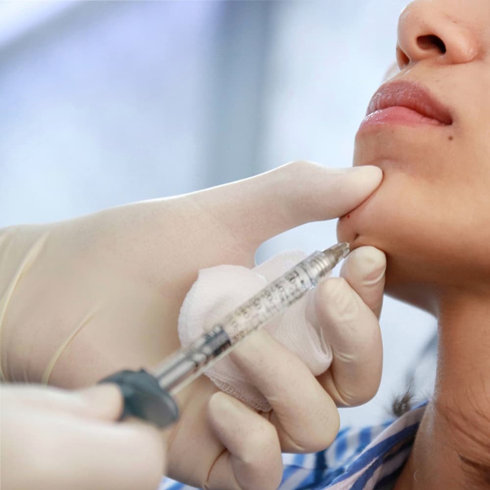 What are the types of dermal fillers? - THE FIRST CHOICE FOR HIGH-END ...